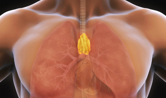Thymus Cancer: Symptoms, Diagnosis and Treatment